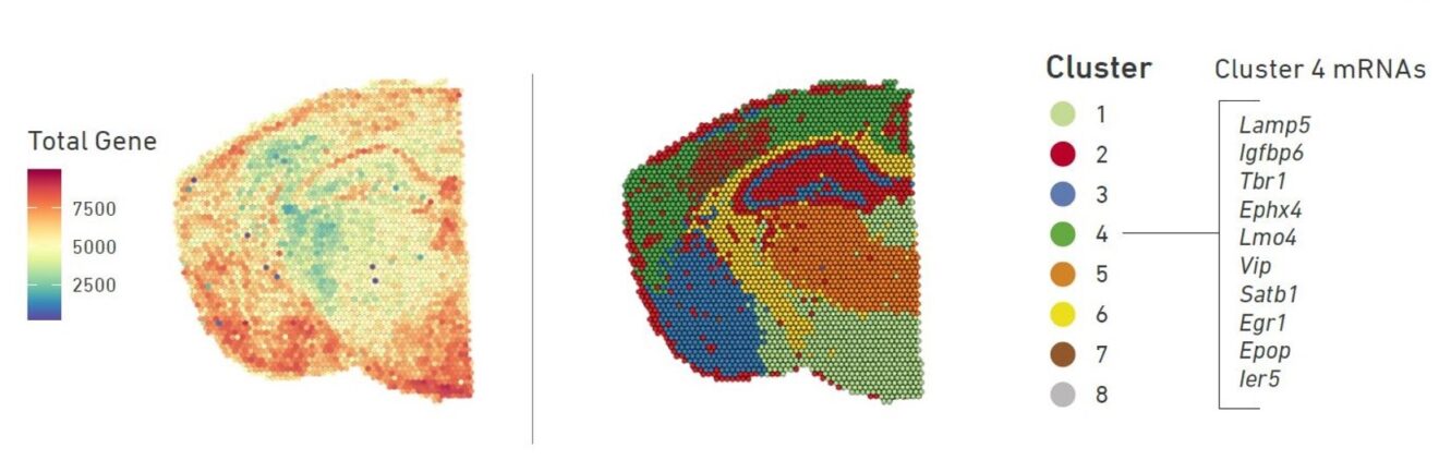 Mise en place de la Spatial Transcriptomic - Bordeaux Neurocampus