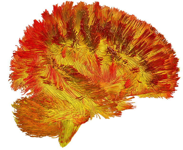 A human brain map of mitochondrial respiratory capacity and diversity ...